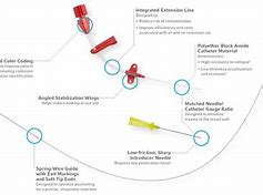 Indwelling Arterial Catheter
