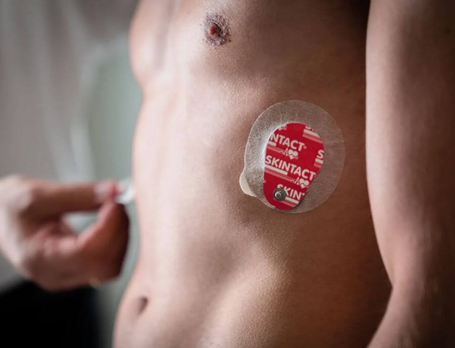 skintact-ecg-electrodes-cardiology-medical-devices-uk